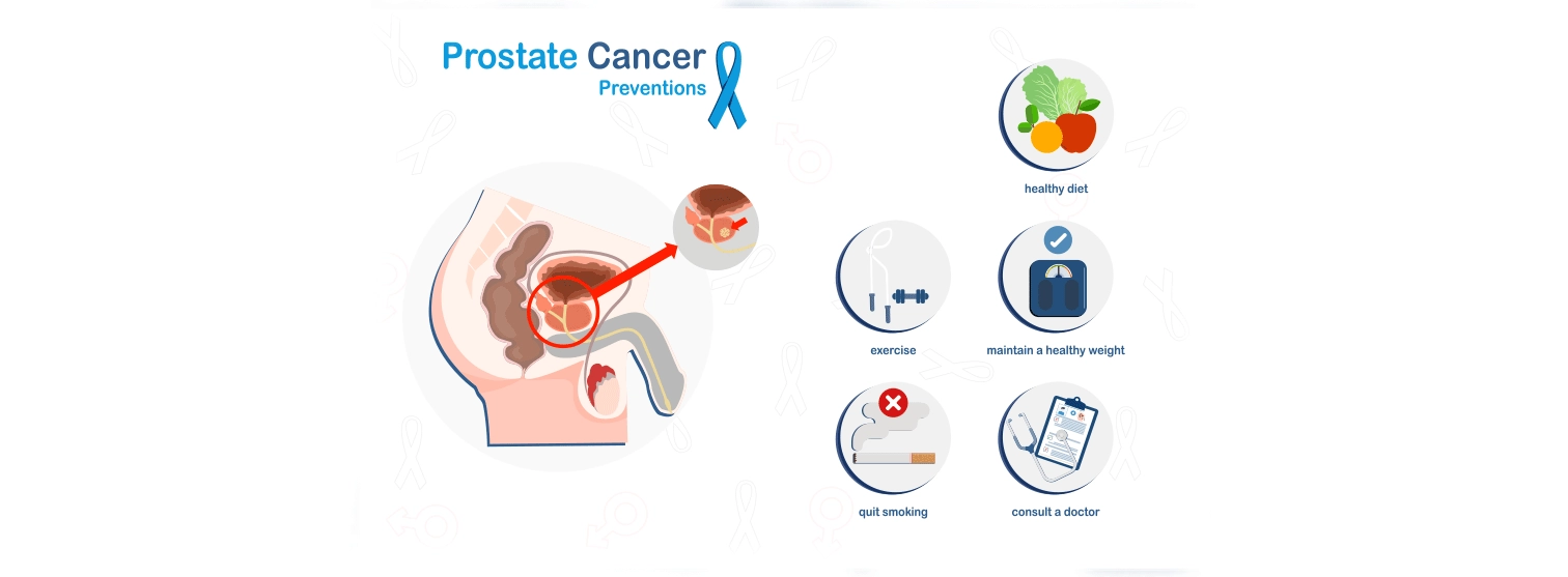 Prostate Cancer: Symptoms, Causes, Types, and Treatment